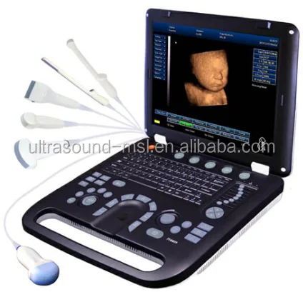 3d/4d Portable Ultrasound System /pregnancy Test Ultrasound Machine ...