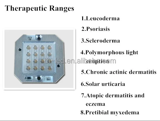 천후이 엑시머 레이저 308nm 건선 레이저 Uv Led 311nm Cob 308 Nm 레이저 치료 Led 모듈 - Buy ...