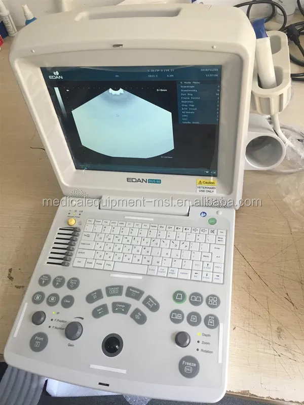 Cheapest Edan DUS 60 Digital Ultrasound Machine for VET Portable
