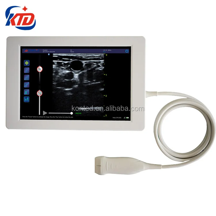 Musculoskeletal Ultrasound Machines With High Resolution Image - Buy ...