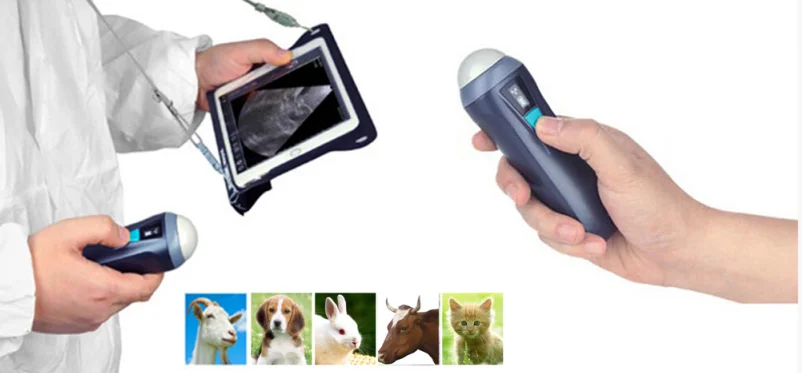 Wireless Sector Probe Scanner - Medical Ultrasound Instrument