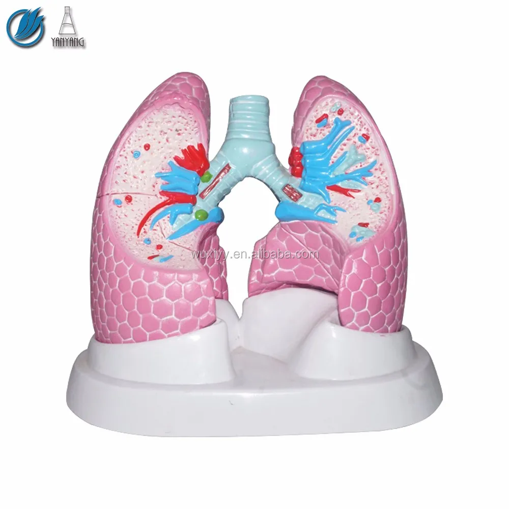 Biology Plastic Human Anatomical Lung Model - Buy Biology Plastic Human ...