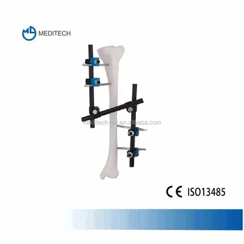 Ao Orthopedic Equipment External Fixation For Tibia - Buy External ...