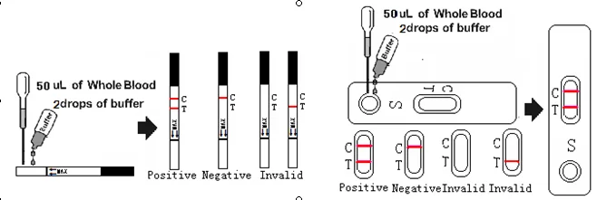 Rapid Diagnostic Tumor Marker Test Kit Psa Test Strip - Buy Tumor ...