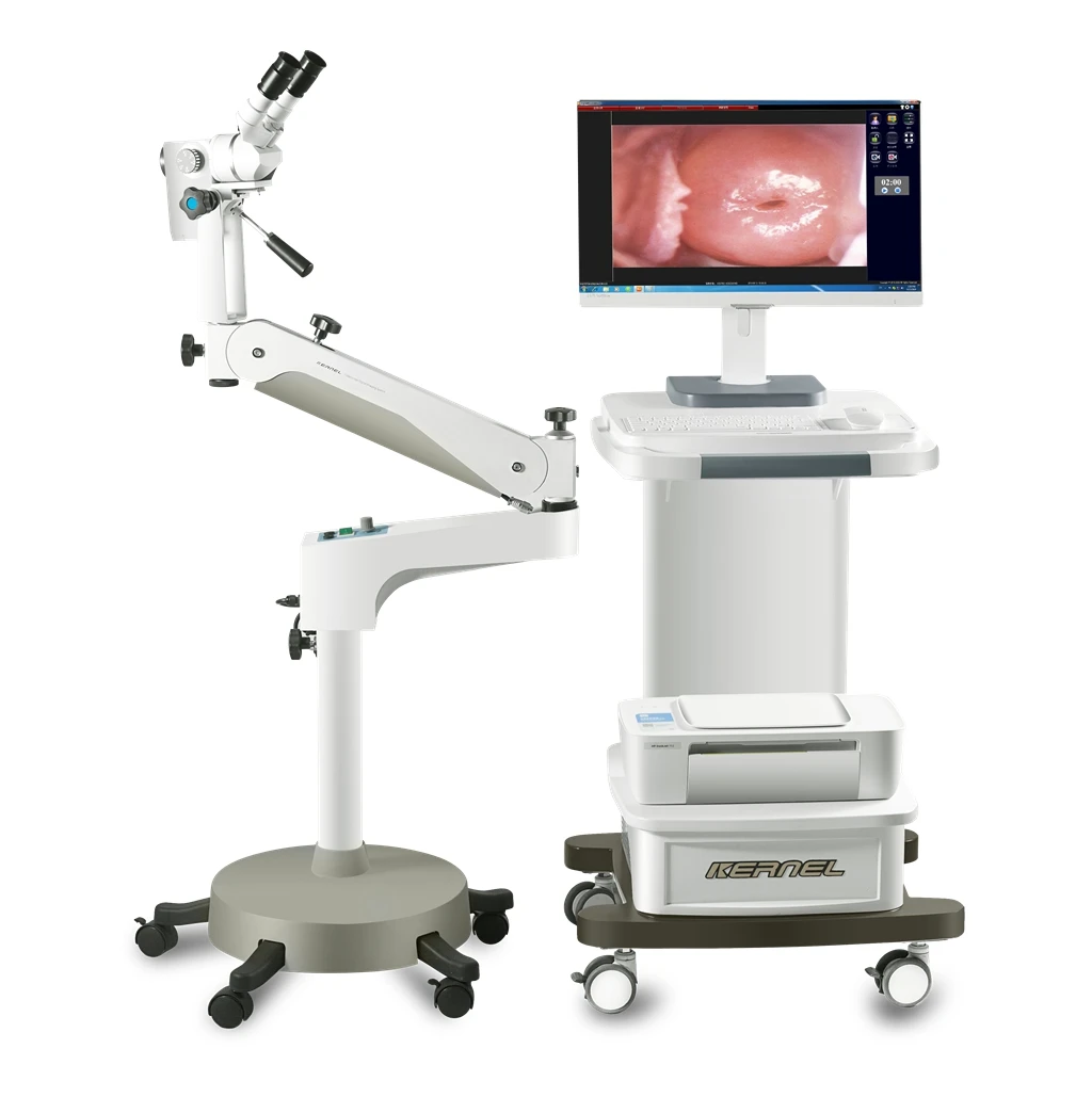 DIGITAL Video Colposcope for Cervical Cancer SCREENING Colposcope ...