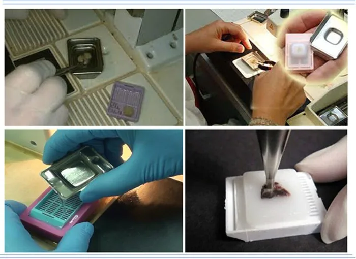 Laboratory Consumable Tissue Base Molds Embedding Cassettes - Buy ...