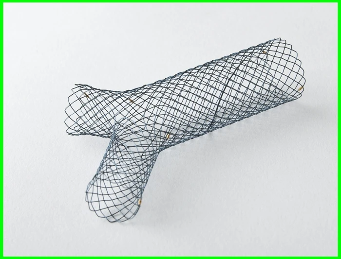 Uncovered Y Shape Tracheal Stent With Introducer - Buy Trachea And ...