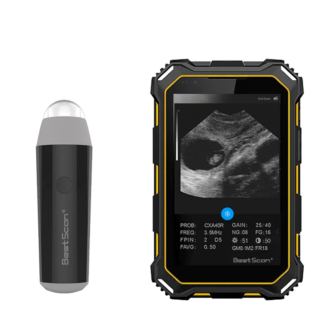 Echography Machine Wifi Ultrasound Probe Handheld Portable Ultrasound ...