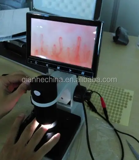 Professional Nailfold Capillary Microcirculation Microscope Test ...