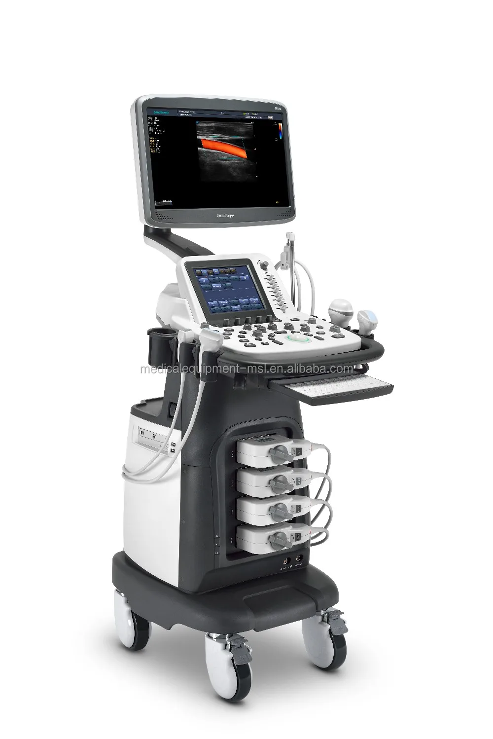 Sonoscape S22 Ultrasound - Advanced Color Doppler Platform