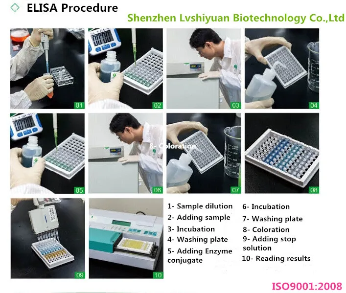 Lsy-30032 Toxoplasma Gondii Igg Antibody Elisa For Cat Toxoplasmosis ...