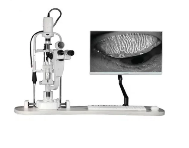 NEW Dry Eye Analyzer Detector Ophthalmology Ocular Surface Analyzer ...