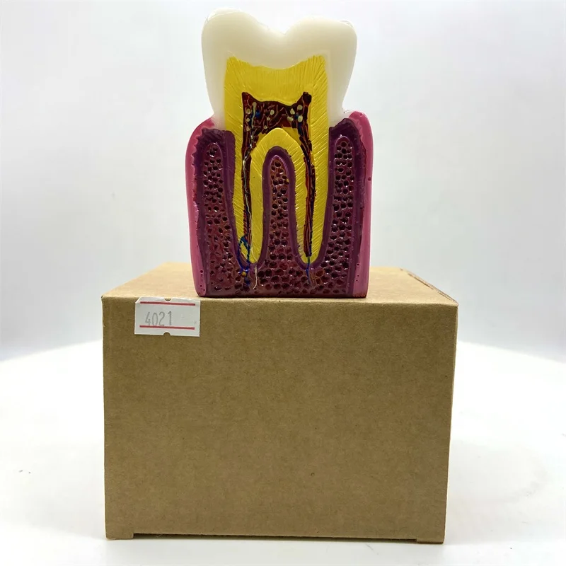 Dental Models M4021 Caries demonstration model with healthy teeth oral ...