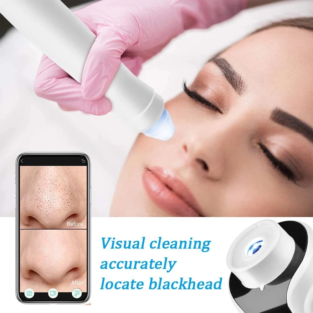 2021 Trending Beauty Instrument Facial Pore Cleanser Pimple Sucker ...