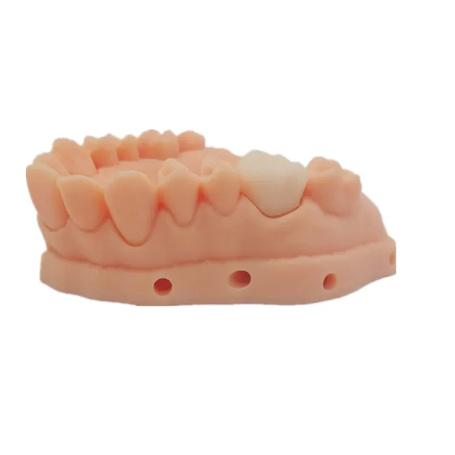 Dental Resin Teeth Dental 3d Pro Model Resin For 385nm 405nm Dlp Lcd ...