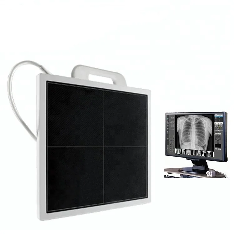 YSFPD1717M High Resolution Excellent Images Portable Wireless X-Ray ...