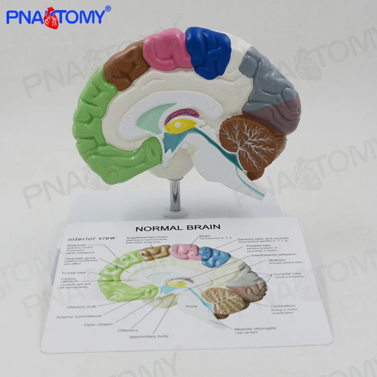Interthalamic Adhesion Sheep Brain