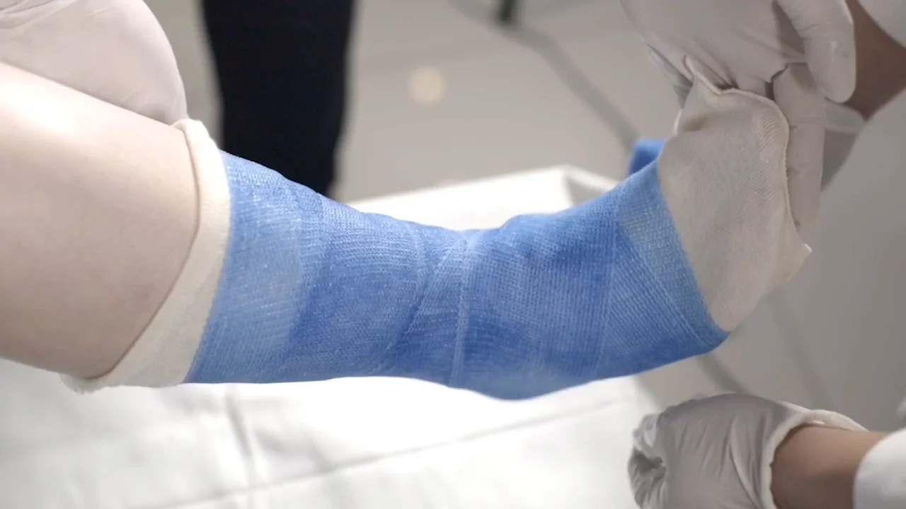 Hospital Consumables Fiberglass Casting Tape Gypsum Bandage Water ...