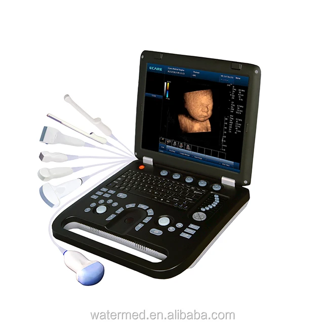 Portable 3d Ultrasound Color Doppler Ultrasound Machine Ultrasonic With ...
