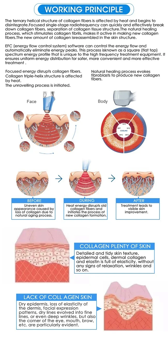 2026 Exilift ultra 360 Desktop Machine Fat Removal Body Contouring ...