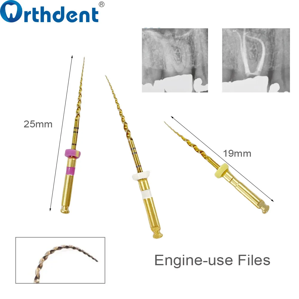 Orthdent Dental Files - Premium Niti Alloy Tools for Endo
