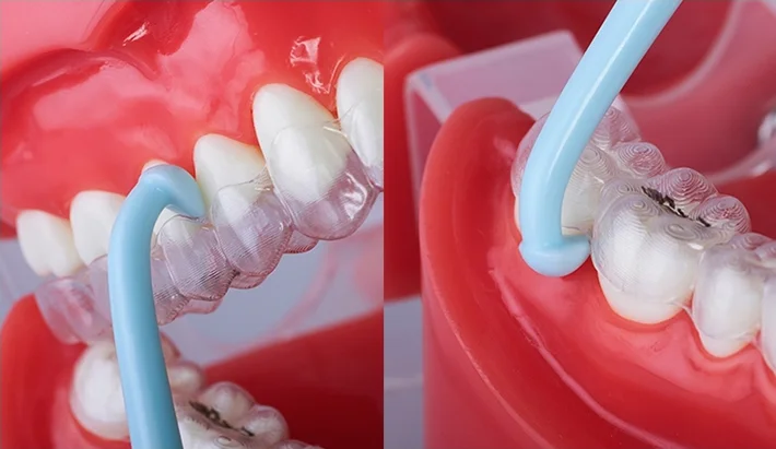 2 in 1 Colorful Tray Remover Invisible Braces Picker Orthodontic Clear ...