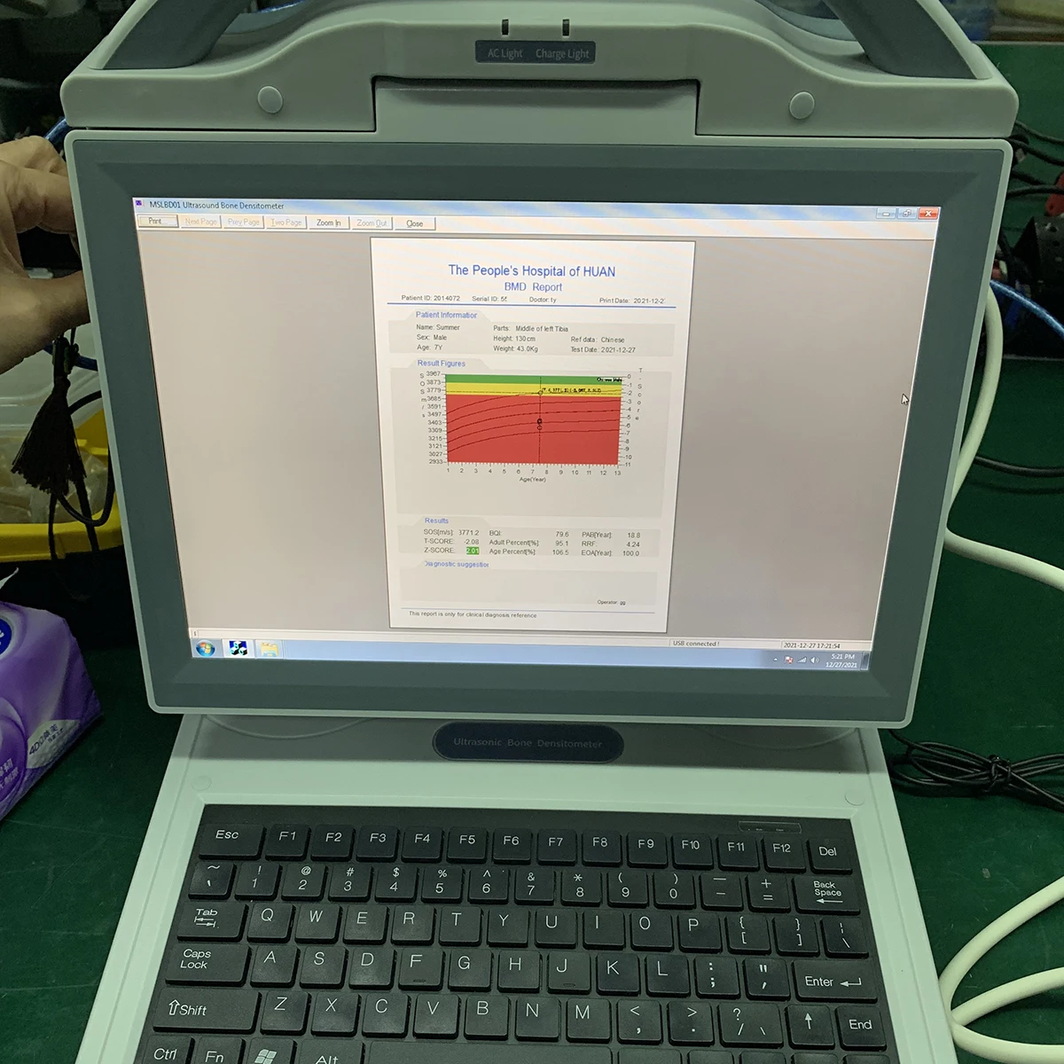 Portable Ultrasound Bone Densitometer Mslbd14 Bone Density Scanner For ...