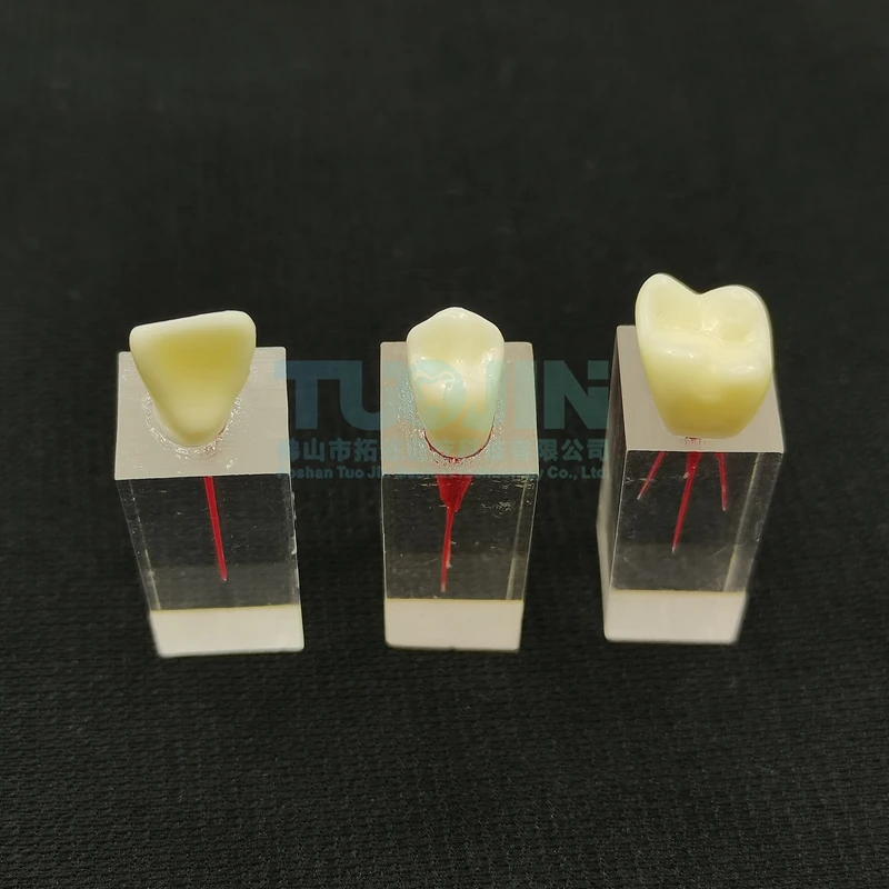 Dental Root Block Teaching Model - Endodontics Training
