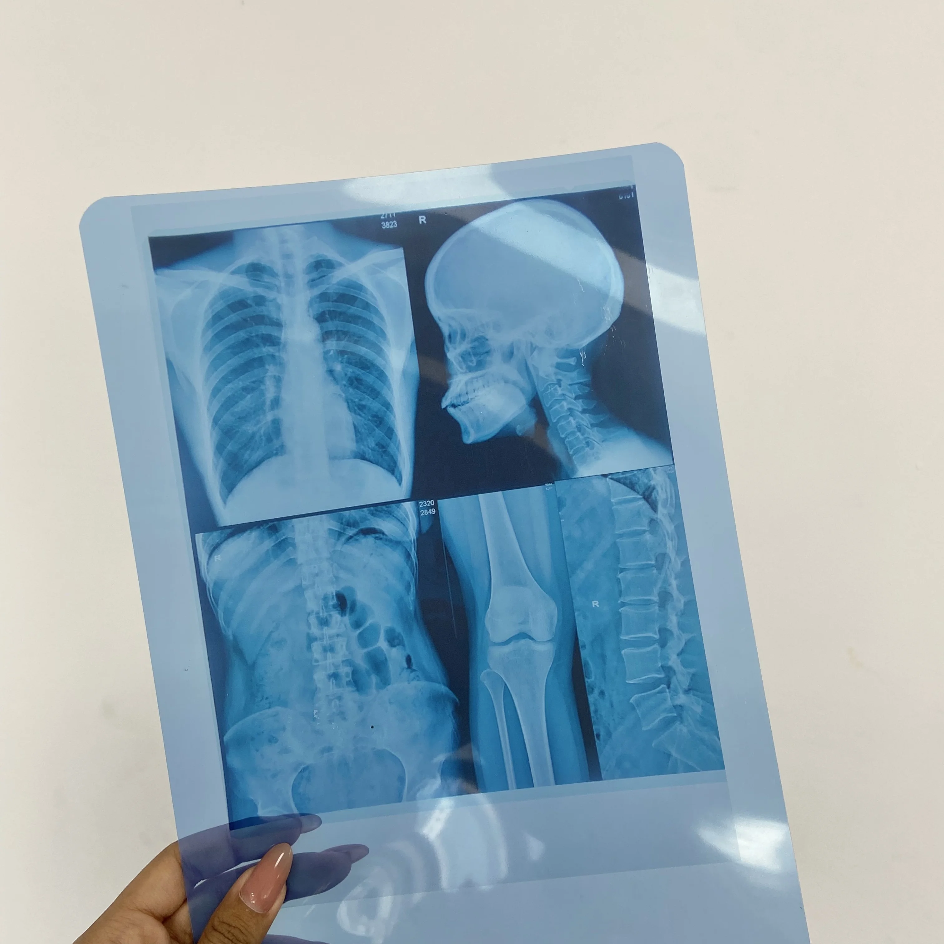 A4 Size Medical Equipment Inkjet Printing X-Ray Blue Film