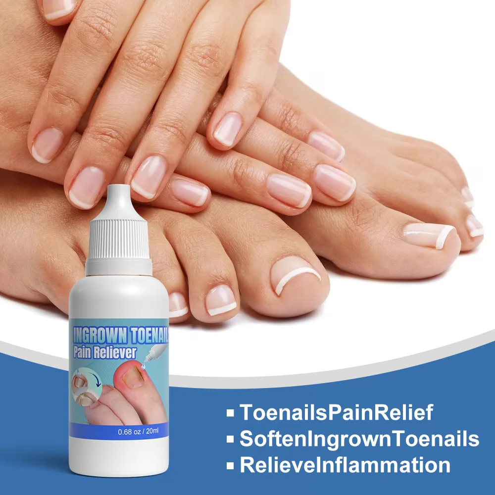 Ingrown Toenails Repair Serum - Deep Nourishing & Anti Infection