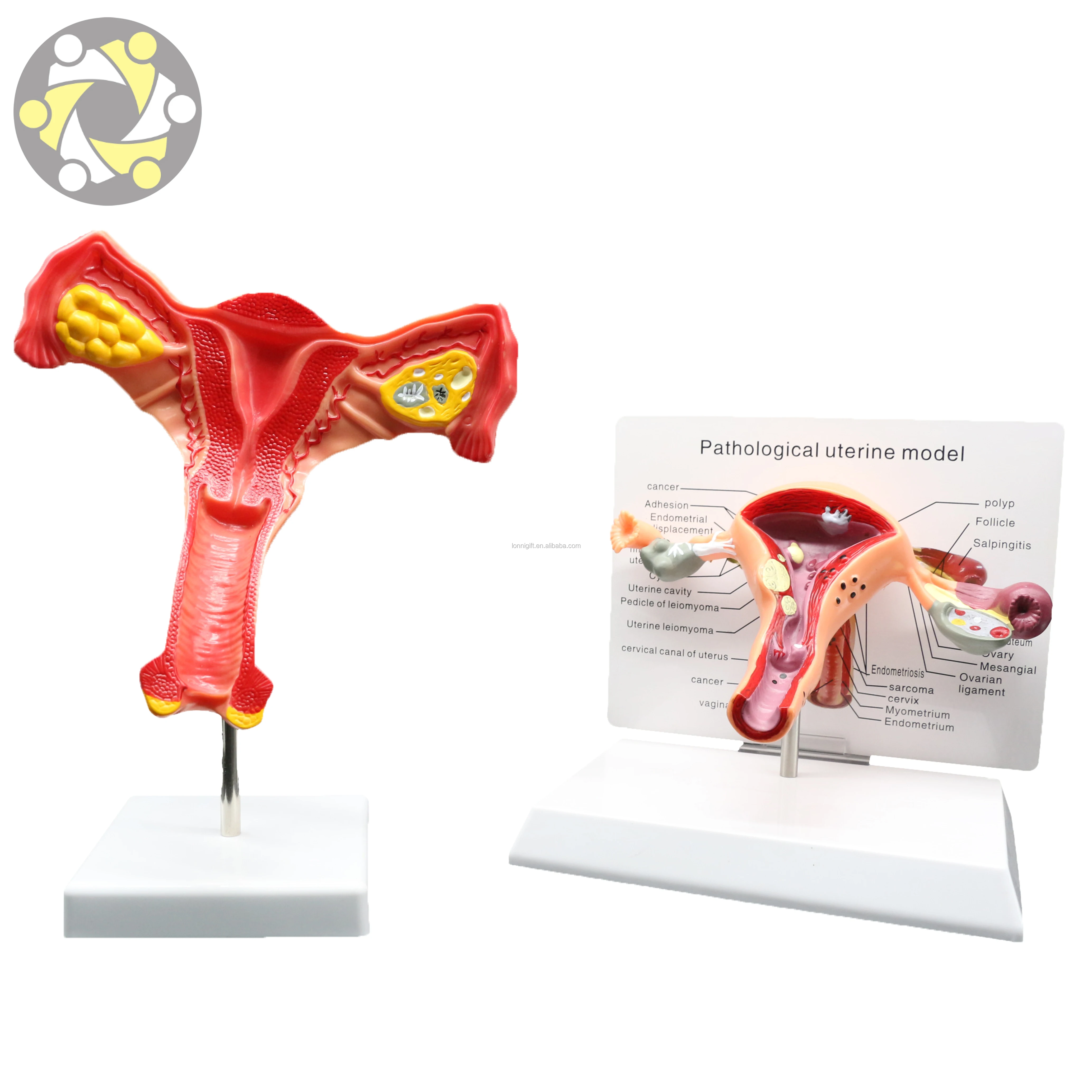 Medical Science Female Anatomy Pathological Uterus Ovary Model| Alibaba.com