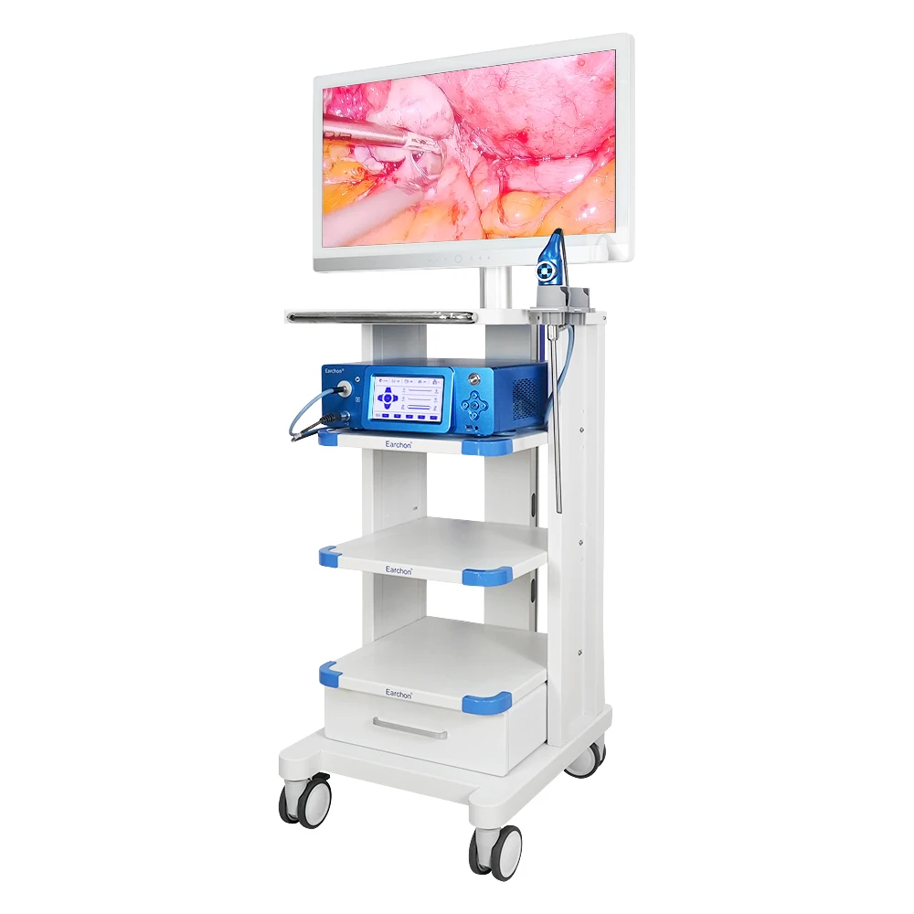 4k Hysteroscope Rigid Endoscope Camera System Medical Endoscope Camera ...