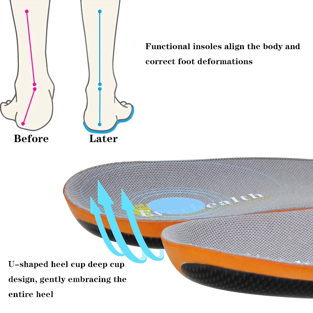 Pu Foam Orthopedic Carbon Fiber Texture Insole Plantar Fasciitis ...