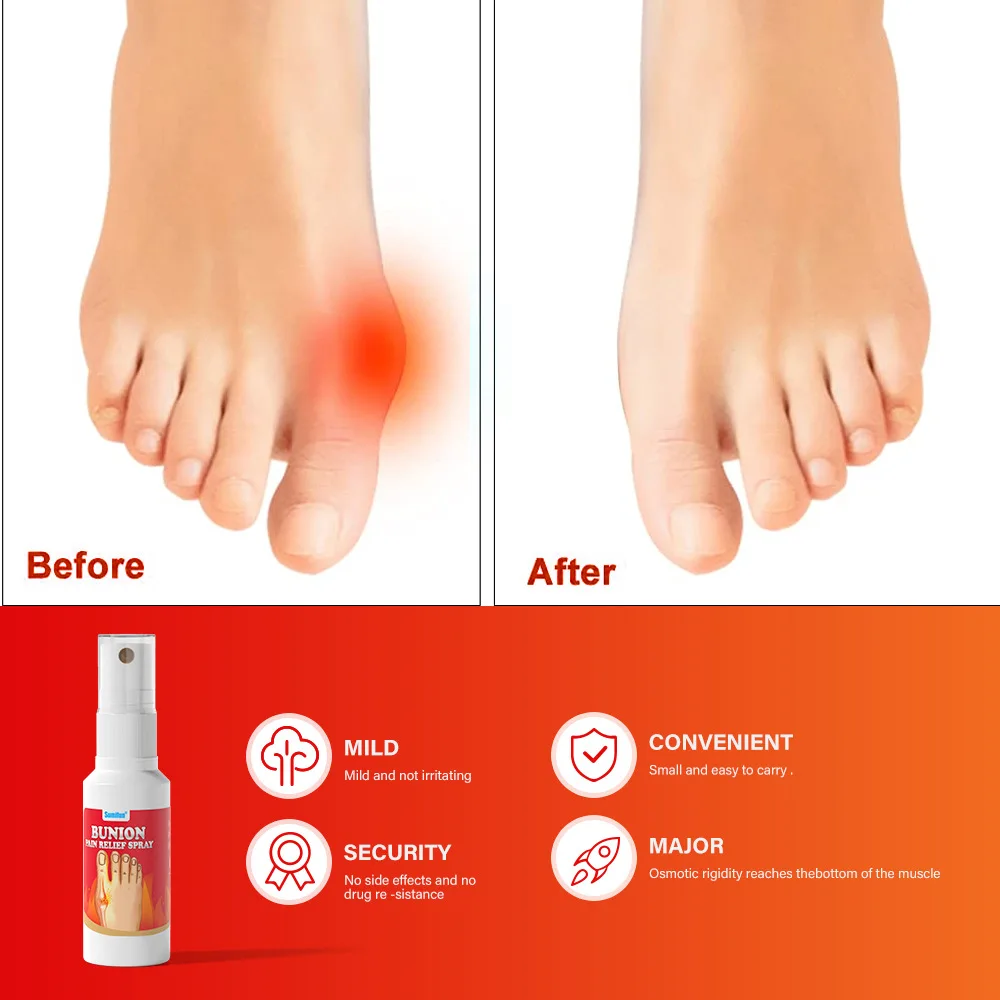 Bunion Arthritis Pain Stiffness Relief Spray Wrist Elbow Knee Pain ...