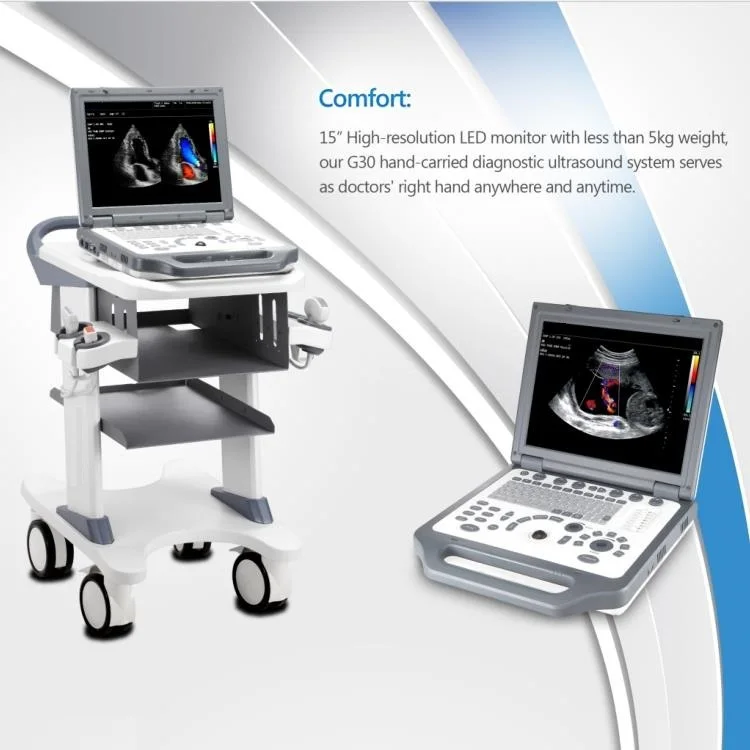 Portable Doppler Ultrasound System And Color Usg Machine With 3d/4d ...