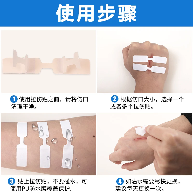 New Medical Adhesive Plaster Butterfly Wound Closure - Sterile ...