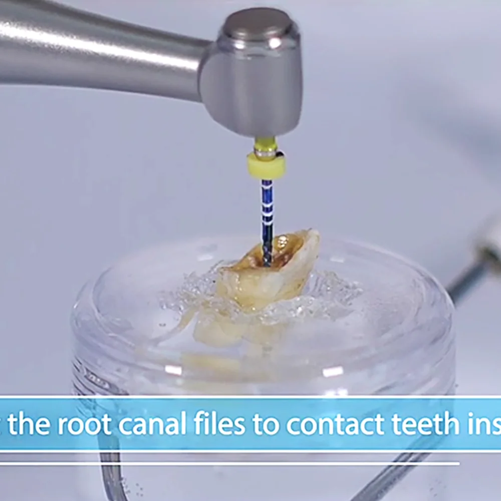 Endodontic 1:1 Rotary Files Wireless Endomotor With Apex Locator ...