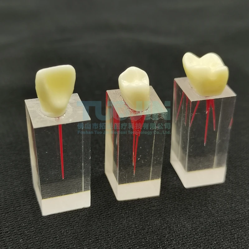 Dental Root Block Teaching Model - Endodontics Training