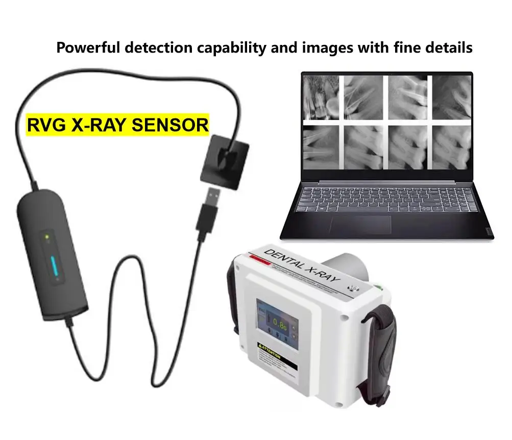 Filmless Usb Digital Intraoral X-ray Imaging Sensor Innovative Photon ...