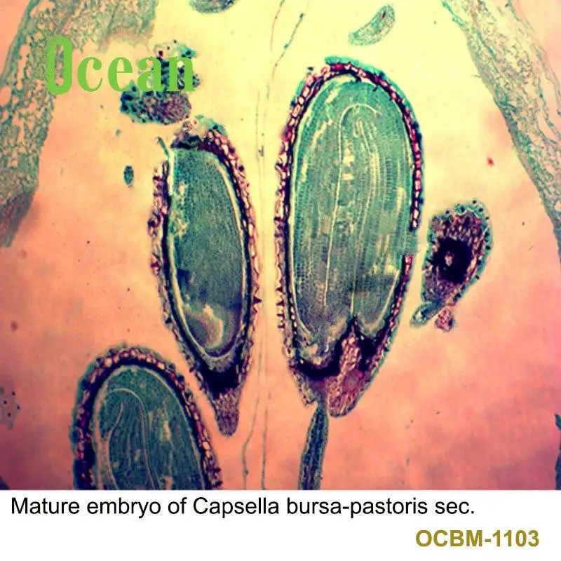 Embryonnaire Mature de Capsella bursa-pastoris sec. microscope préparé ...