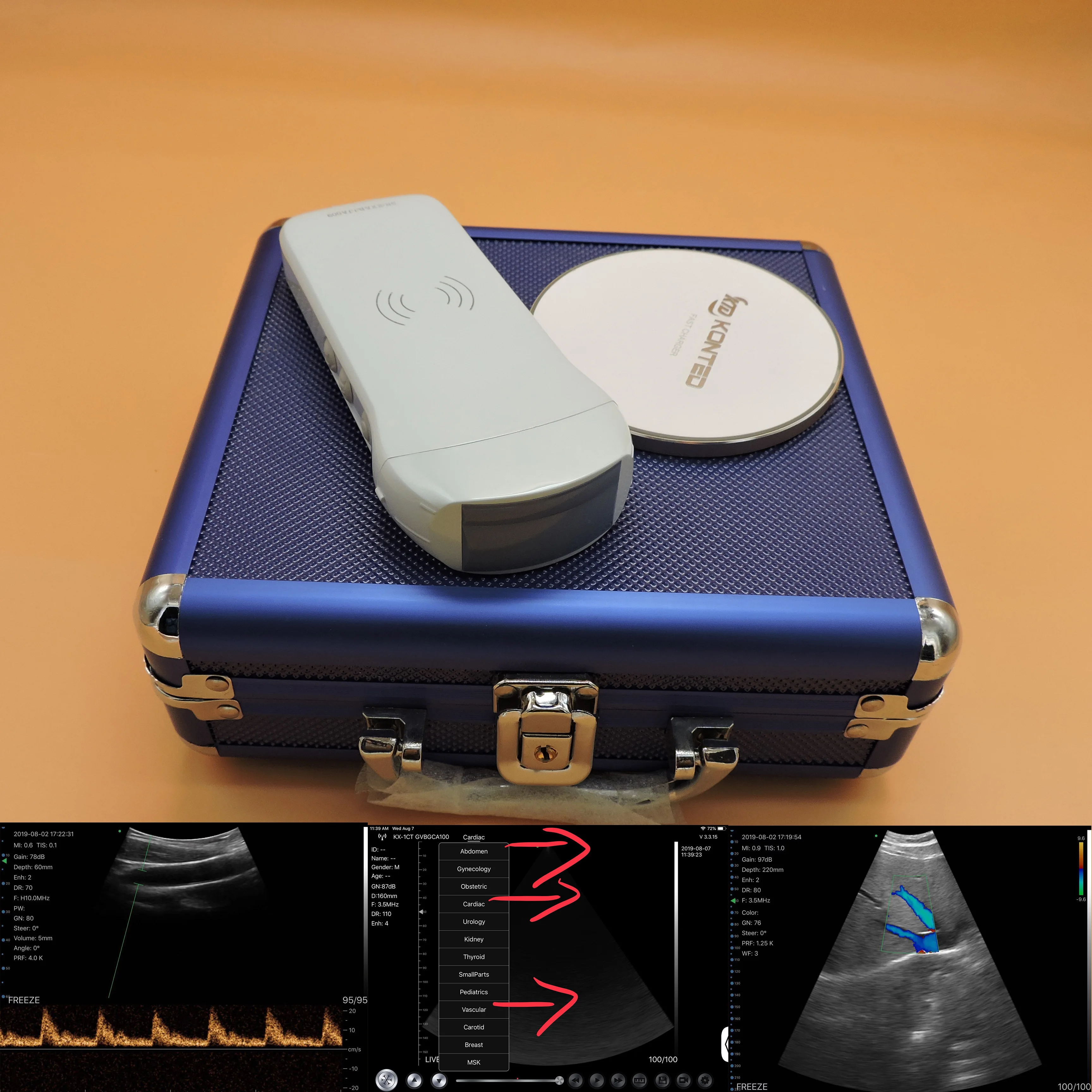 Konted Gen5 Palm Ultrasound Portable Wireless Ultrasound Machine 3 In 1 Multifunctional Single ...