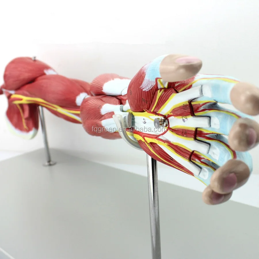 The Dissection Model Of Upper Limb - Buy The Dissection Model Of Upper ...