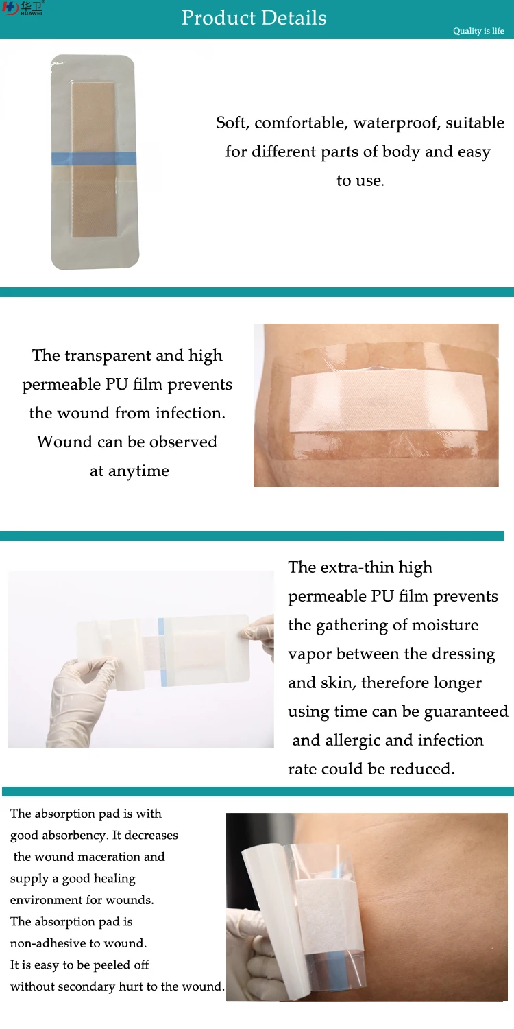 Transparent Wound Dressing And Waterproof Wound Dressing - Buy Wound ...