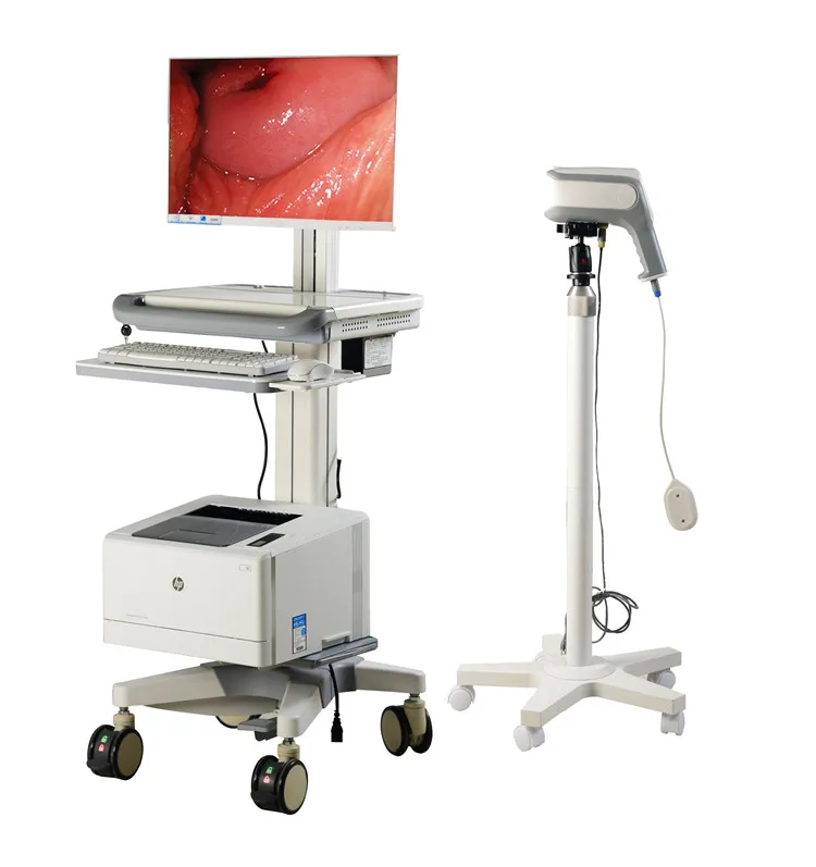 Clinical Vaginal Ccd Camera Digital Video Colposcope For Gynecology ...
