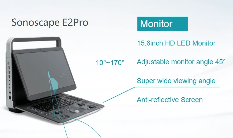 Sonoscape E2Pro彩色多普勒超声机价格| Alibaba.com