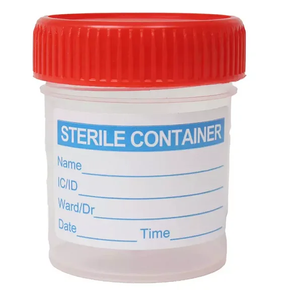 Disposable 60ml Sterile Urine Cup Sterile Specimen Urine Containers ...