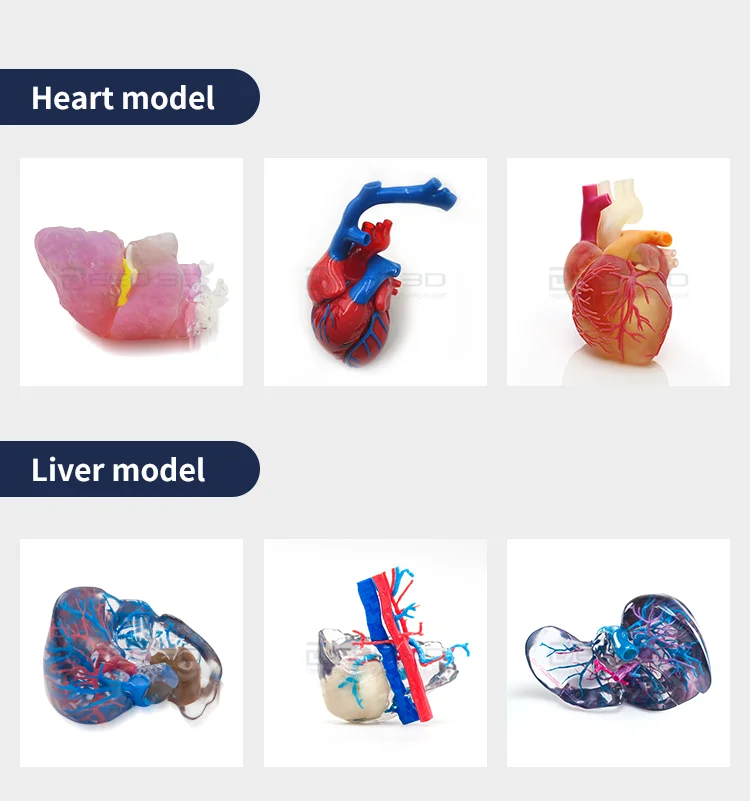 Polyjet Stratasys 3d Printing Service For Heart Model Part - Buy ...