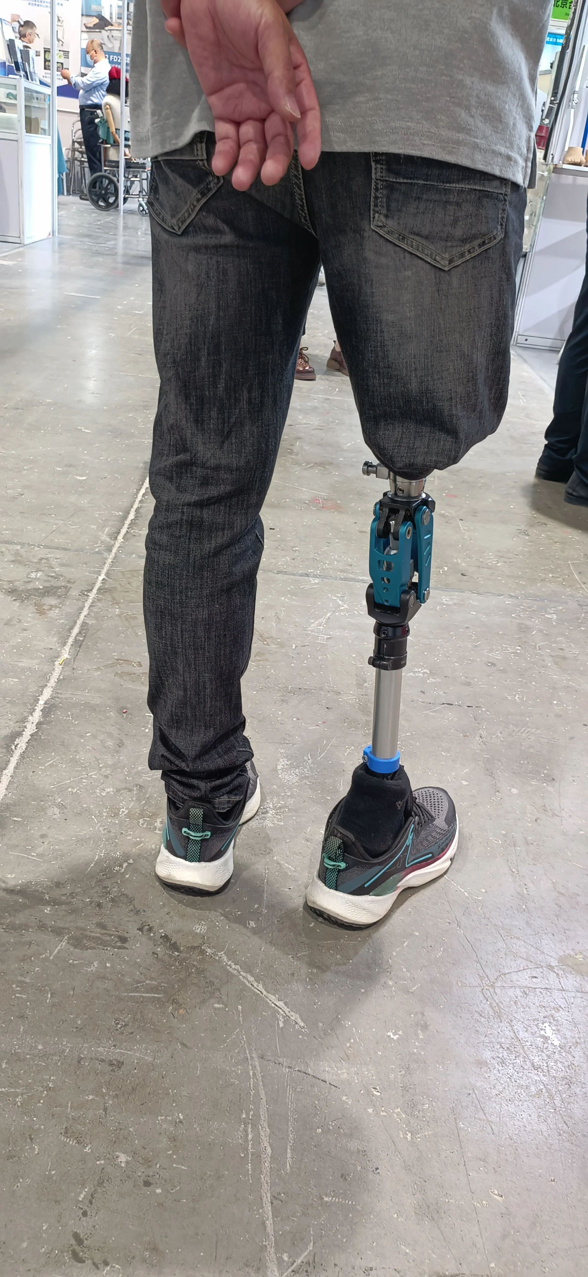 Prosthetic Hydraulic Knee Joint for Artificial Limbs
