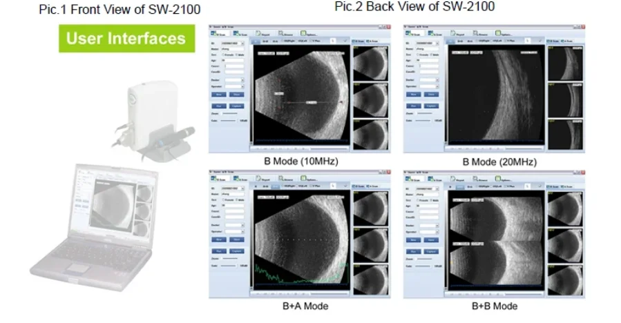 SW-2100 USB Interfaced Ophthalmic Av/B Scan with Best Quality and ...