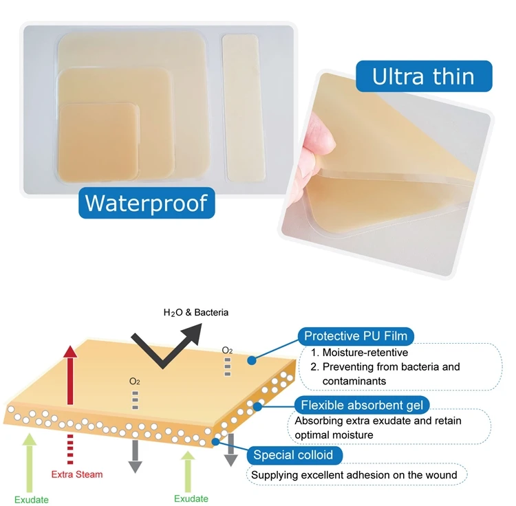 Medical Supplies Hydrocolloids For Hydrocolloid Dressing 15x15cm - Buy ...
